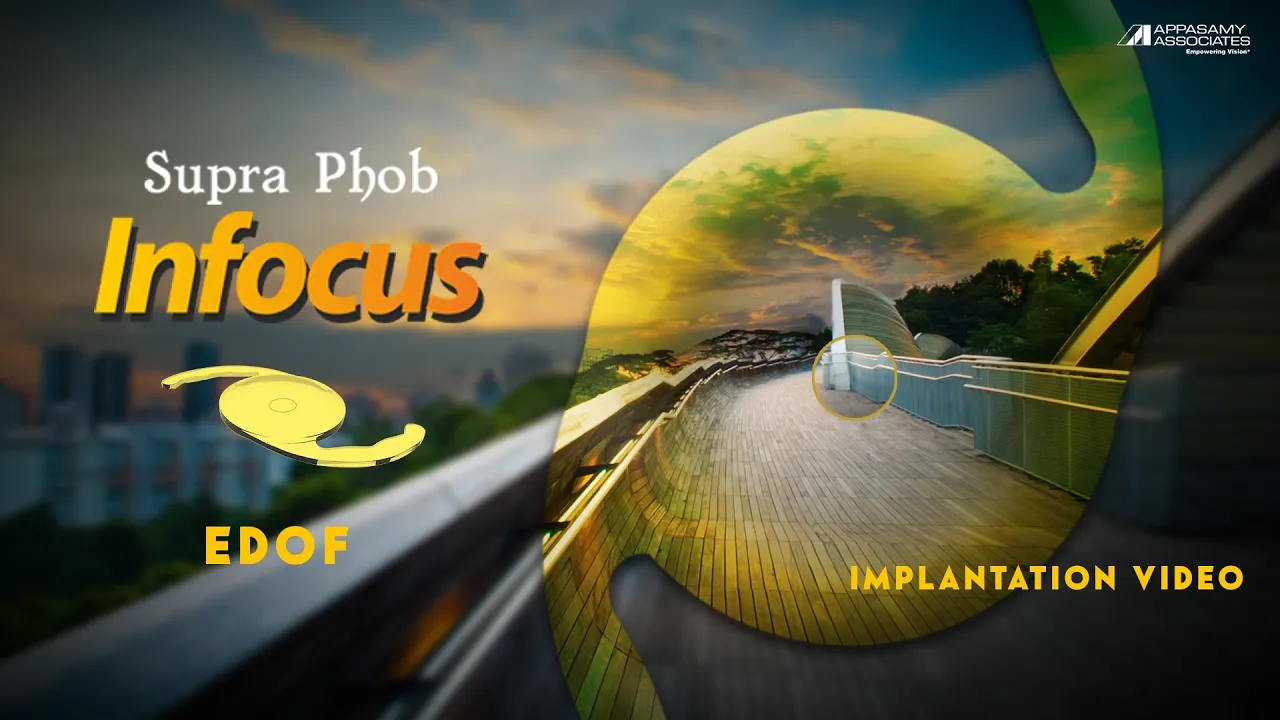 Supra Phob Infocus - Appasamy Hydrophobic Acrylic Lens/ Surgical IOL